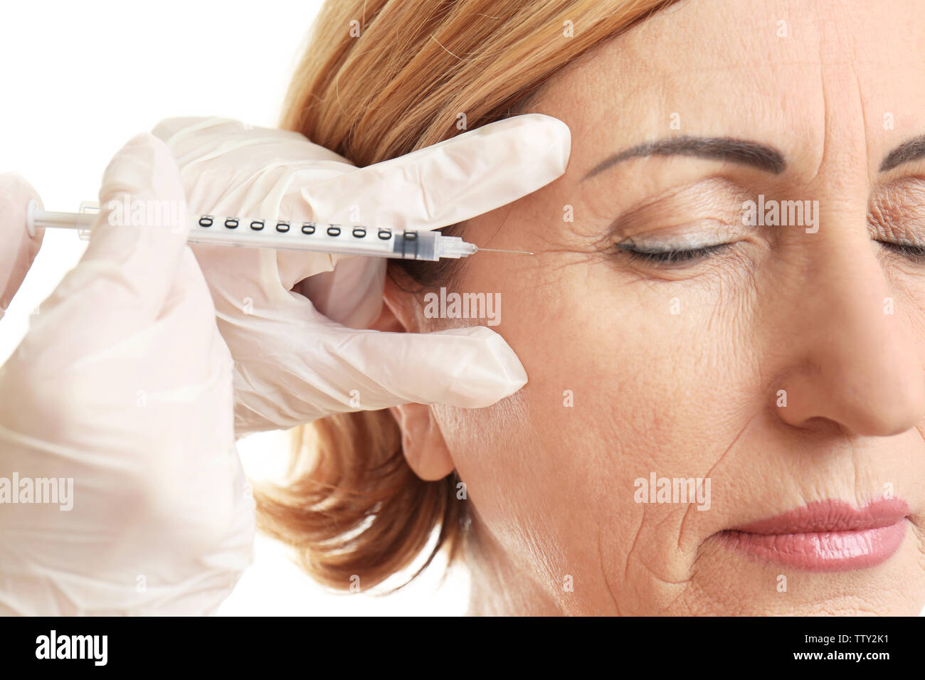 Hyaluronic acid injection for facial rejuvenation procedure Stock Photo ...