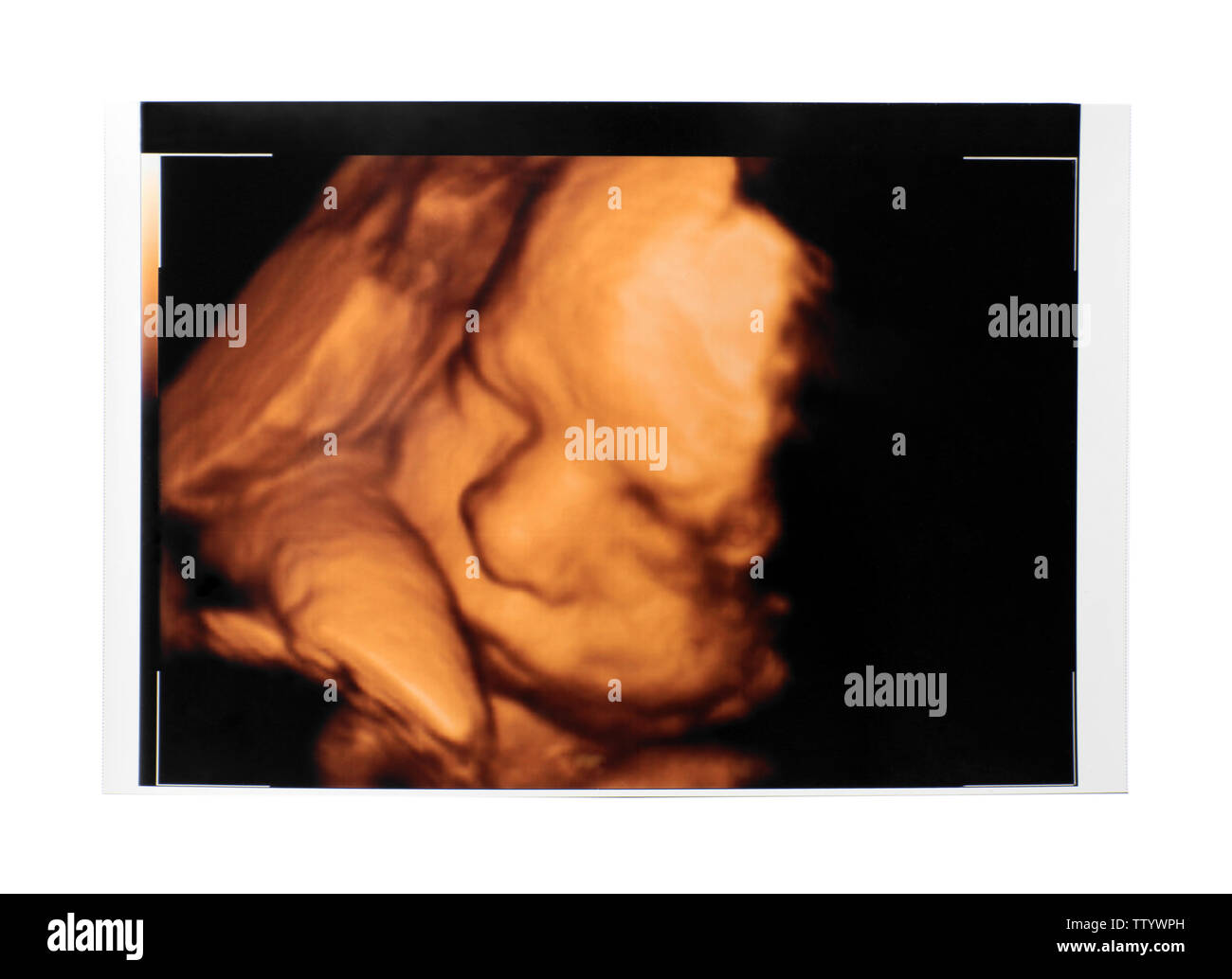Ultrasound scan baby womb Cut Out Stock Images & Pictures - Alamy