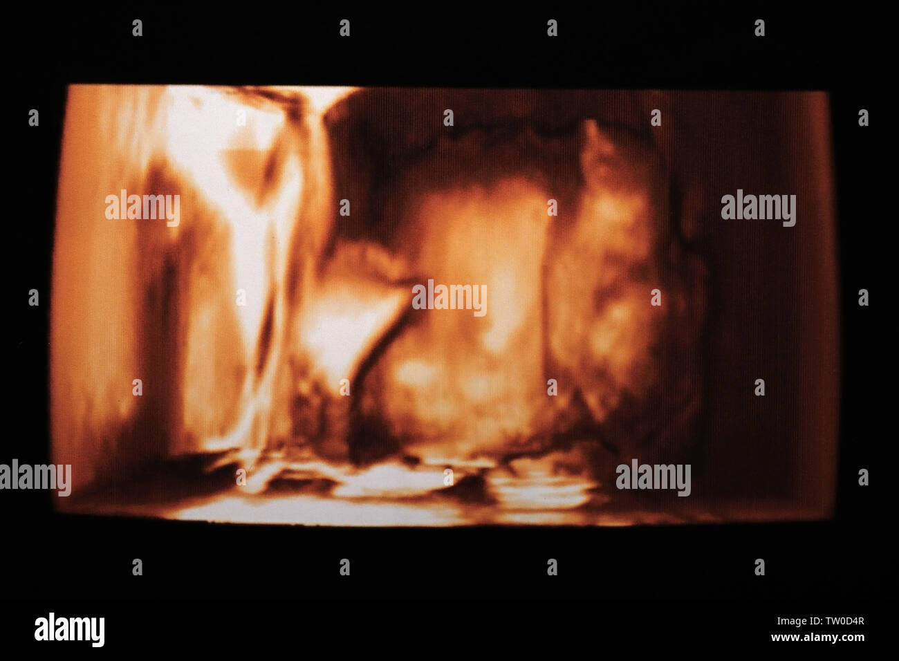 Baby scan 3d hi-res stock photography and images - Alamy