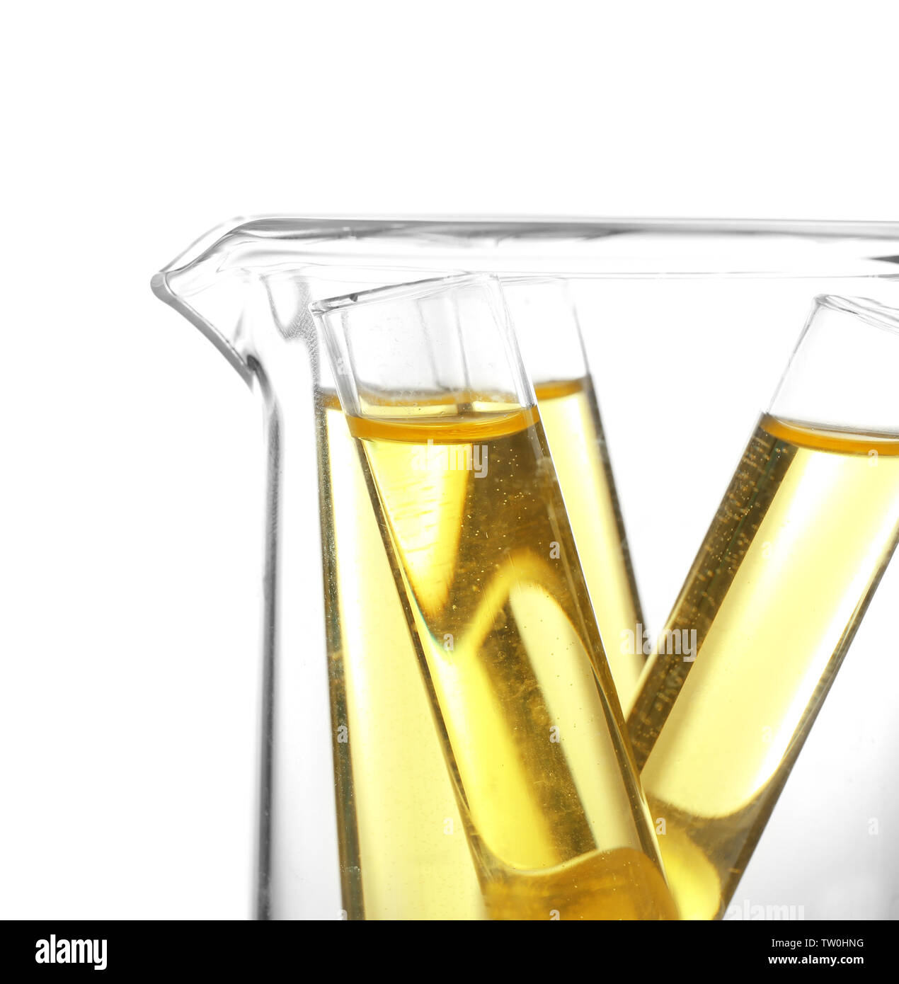Test tubes with urine in beaker on white background Stock Photo - Alamy