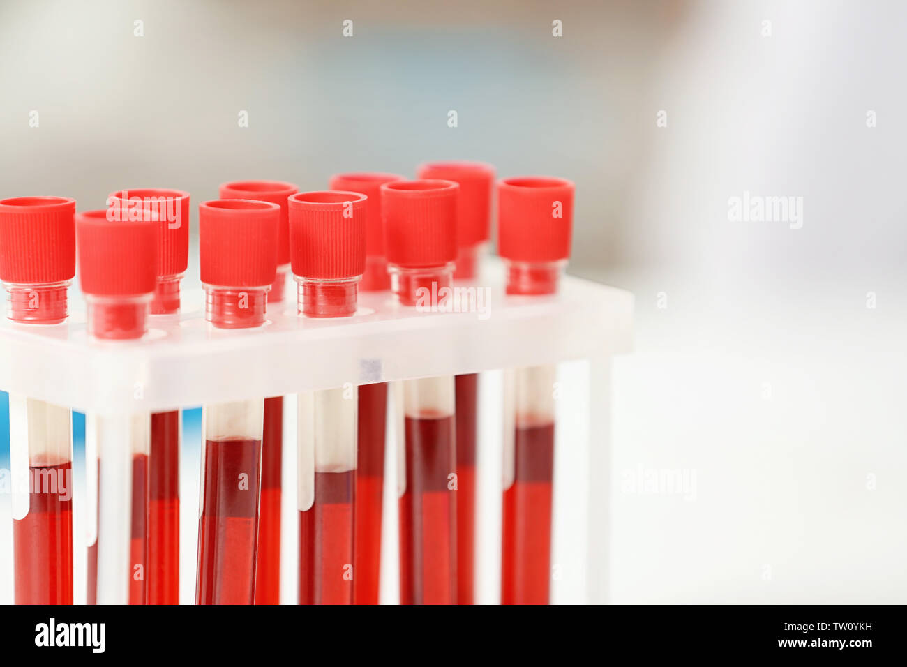 Test tubes with blood in laboratory on blurred background Stock Photo ...
