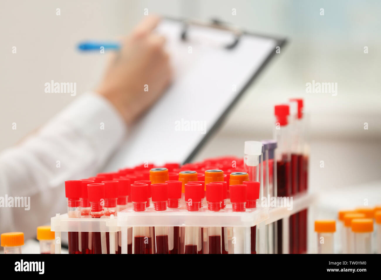 Test tubes filled with blood in laboratory Stock Photo - Alamy
