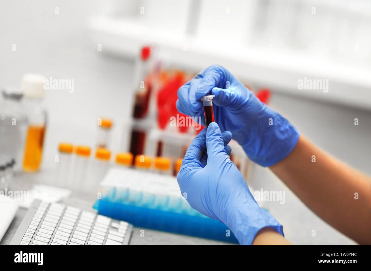 Scientist working with blood sample in laboratory Stock Photo - Alamy