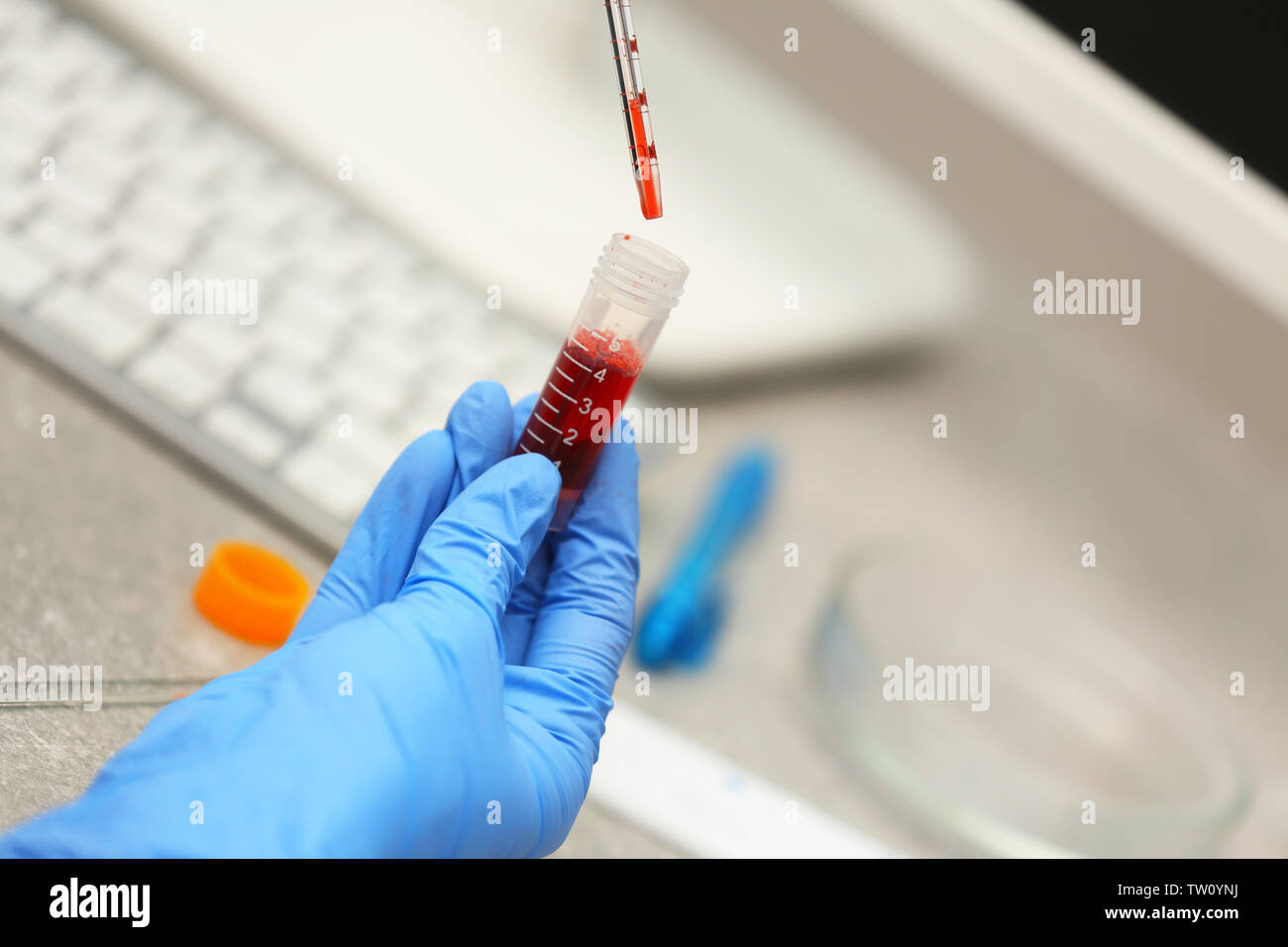 Scientist working with blood sample in laboratory Stock Photo - Alamy
