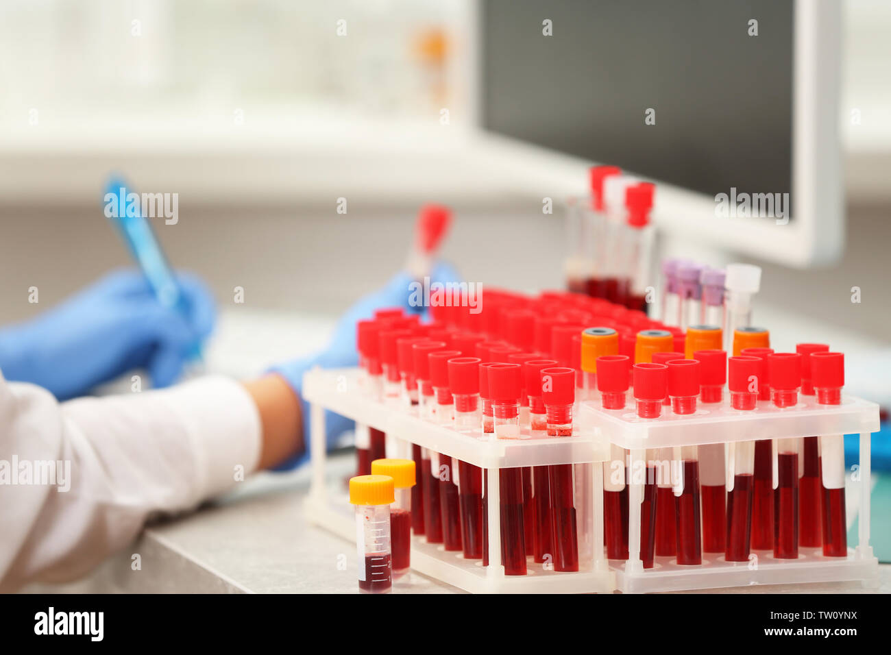 Test tubes filled with blood in laboratory Stock Photo - Alamy