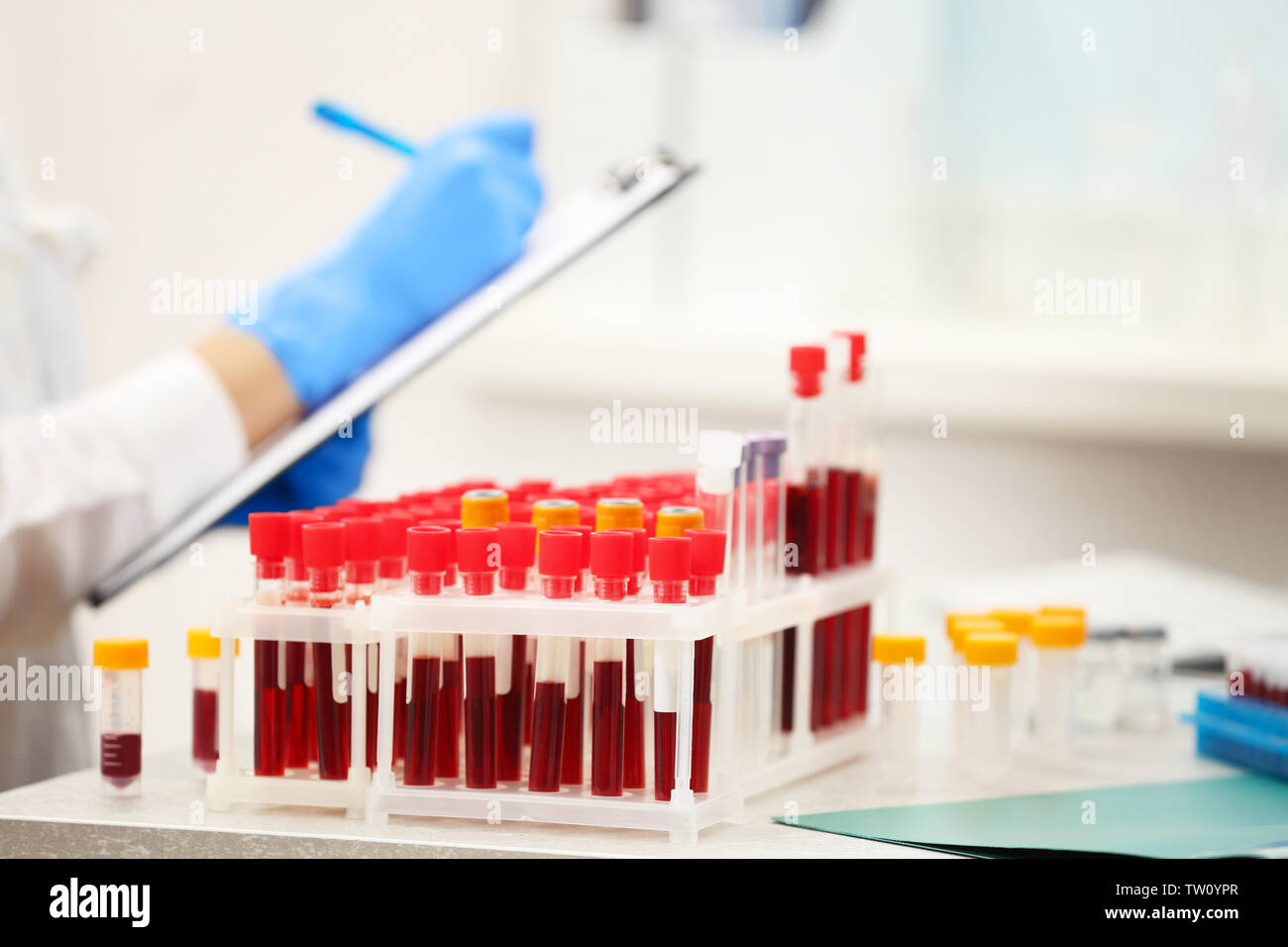 Test tubes filled with blood in laboratory Stock Photo - Alamy