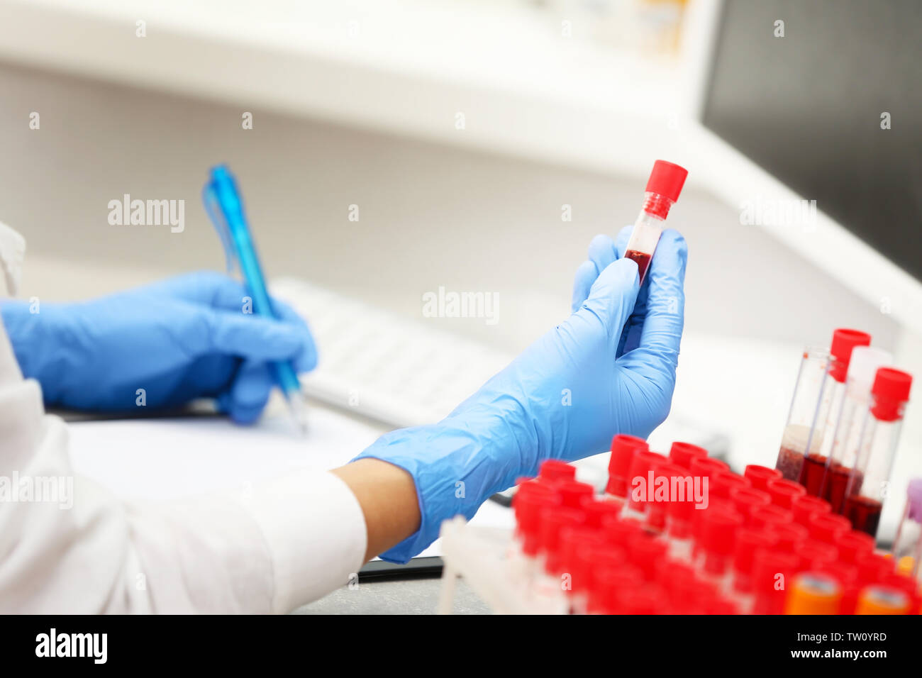Scientist working with blood sample in laboratory Stock Photo - Alamy