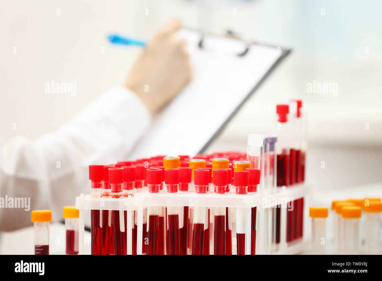 Test tubes filled with blood in laboratory Stock Photo - Alamy