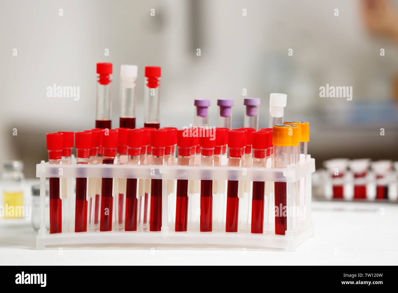Test tubes with blood samples on table in laboratory Stock Photo - Alamy