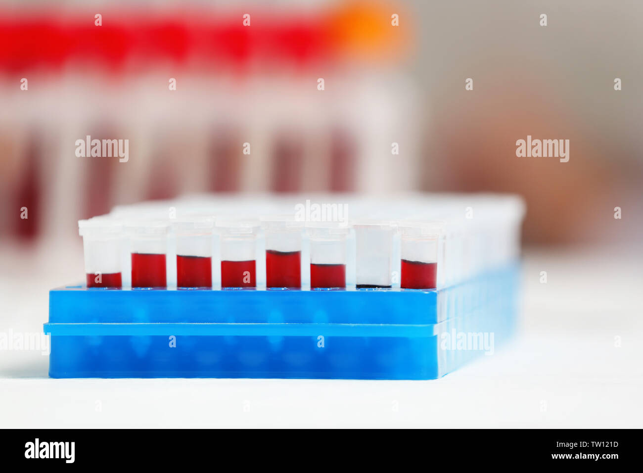 Test tubes with blood samples on table in laboratory Stock Photo - Alamy