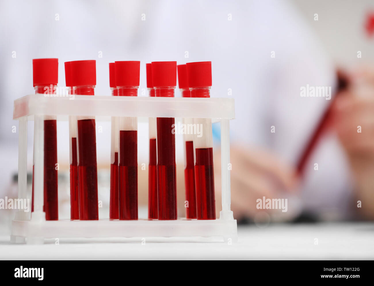Test tubes with blood samples on table in laboratory, closeup Stock ...