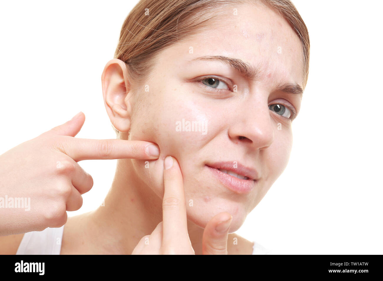Popping acne hi-res stock photography and images - Alamy