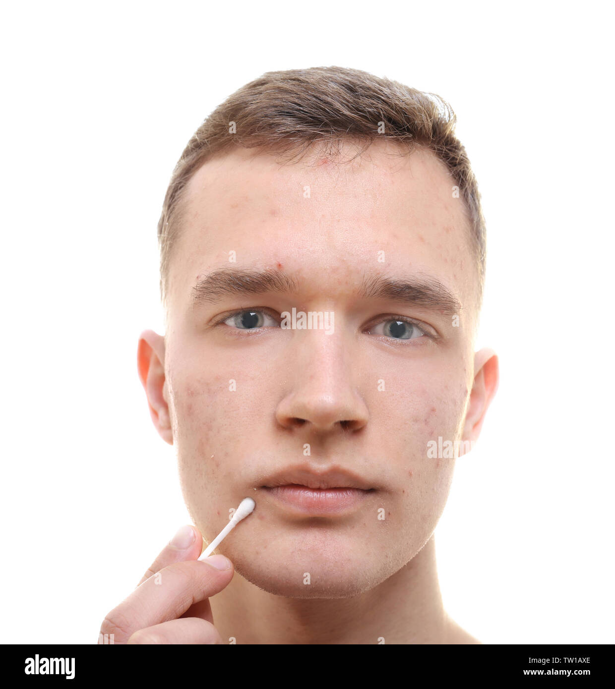 Bud scars hi-res stock photography and images - Alamy