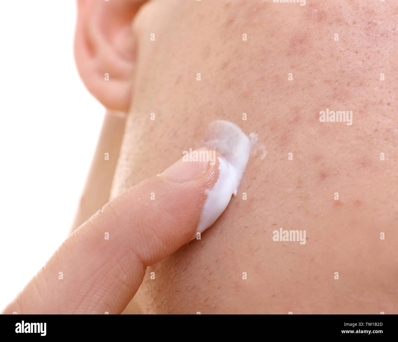 Abscess removal hi-res stock photography and images - Alamy