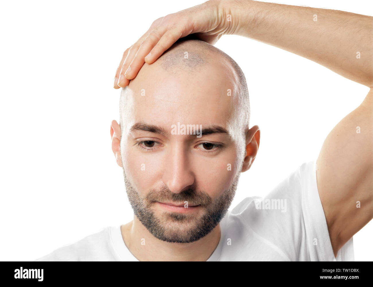 Hair loss concept. Man touching his bald head on white background Stock ...