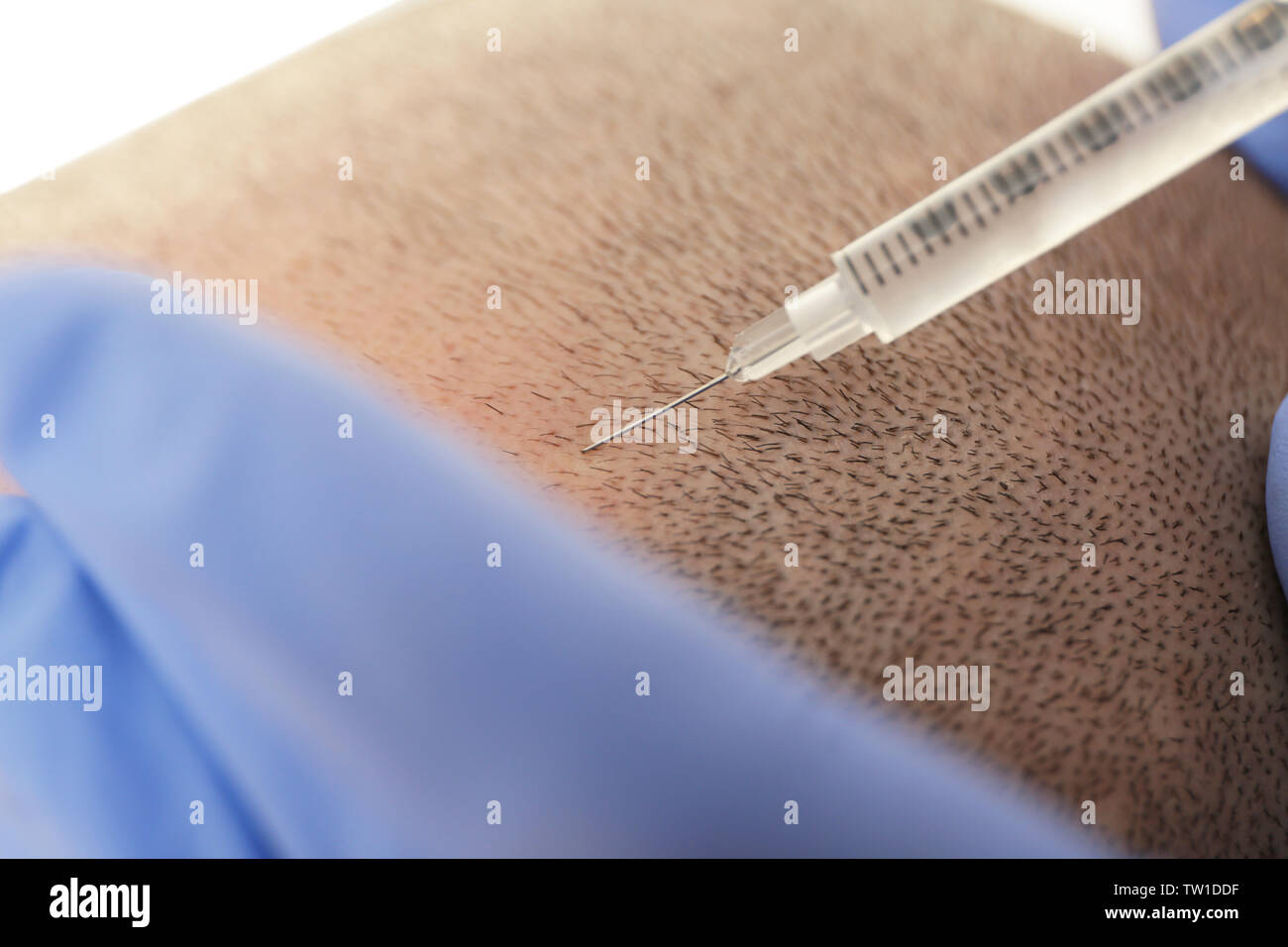 Man receiving stimulating injection for hair growth, closeup Stock ...