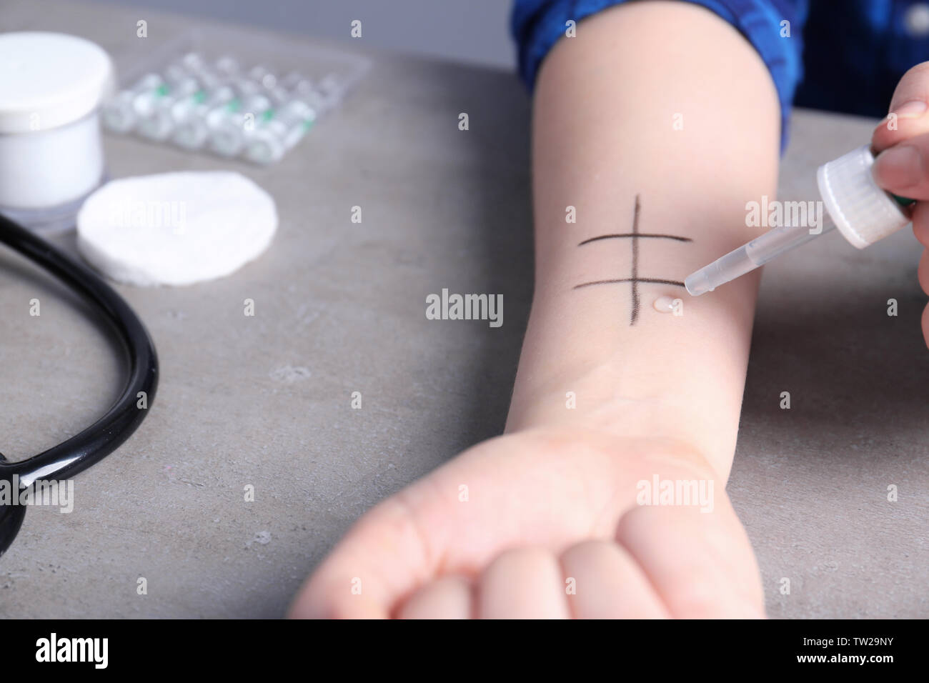 Patient making allergy test in laboratory Stock Photo - Alamy