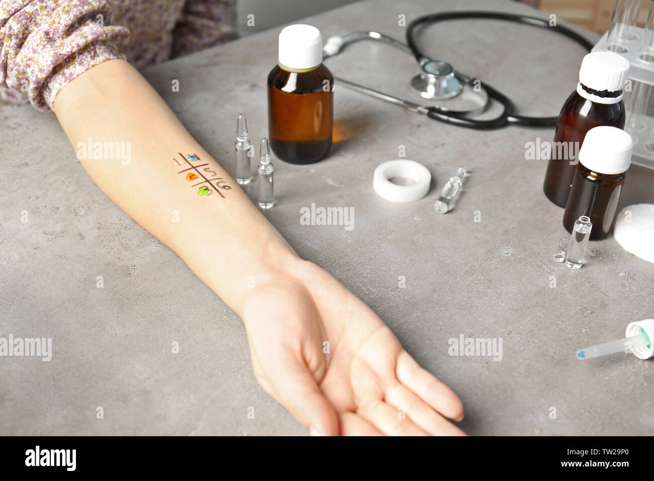 Patient making allergy test in laboratory Stock Photo - Alamy