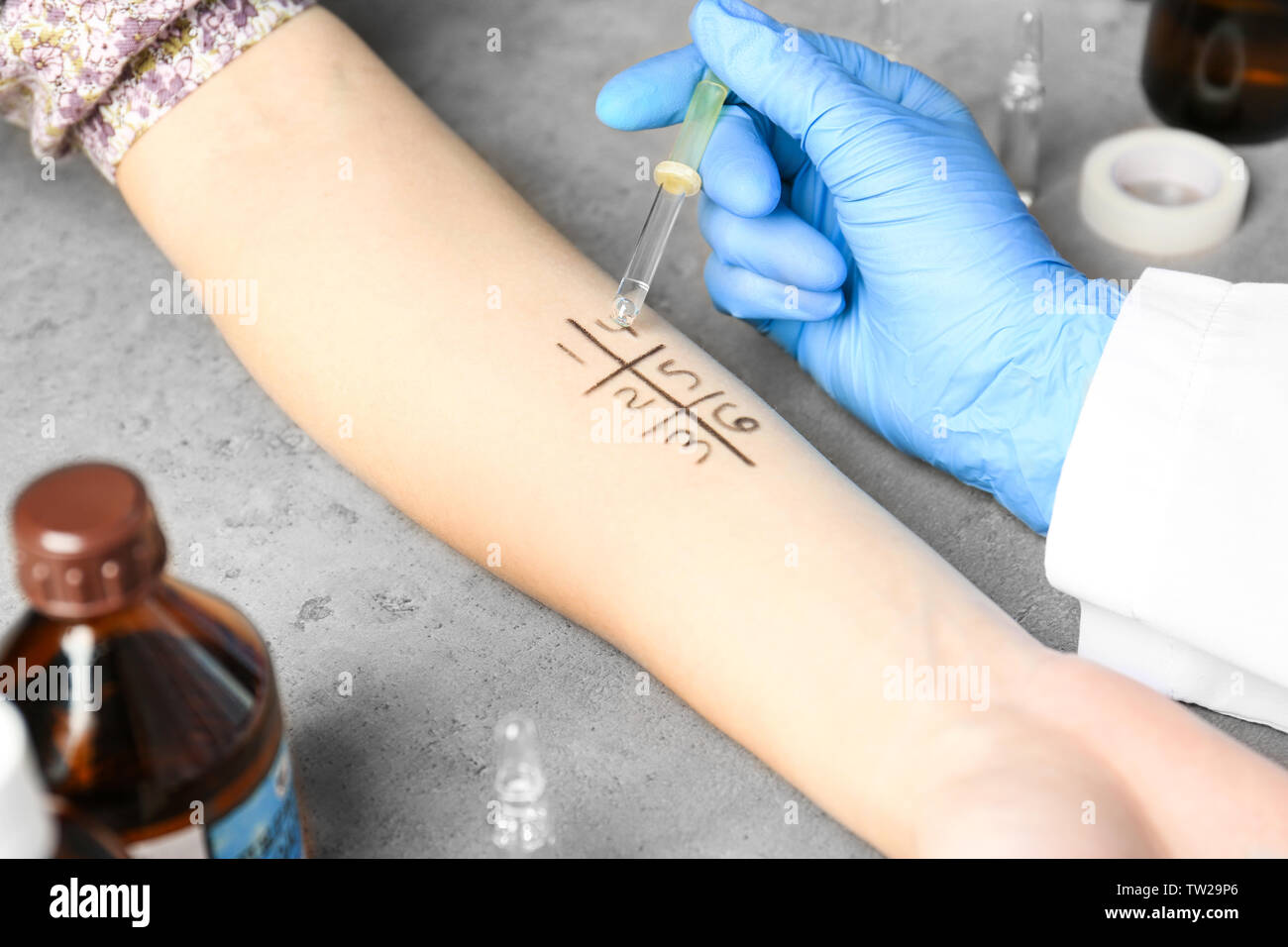 Doctor making allergy test in laboratory Stock Photo - Alamy
