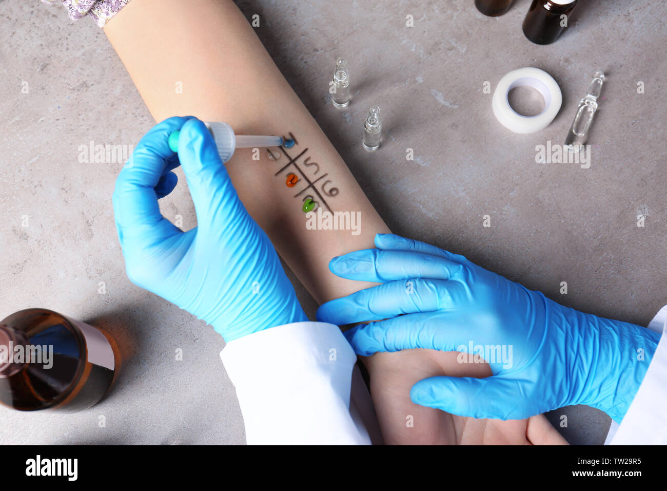Doctor making allergy test in laboratory Stock Photo - Alamy