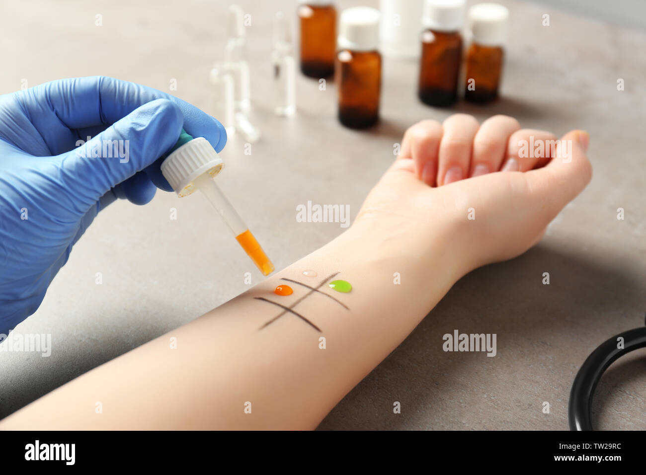 Patient making allergy test in laboratory Stock Photo - Alamy