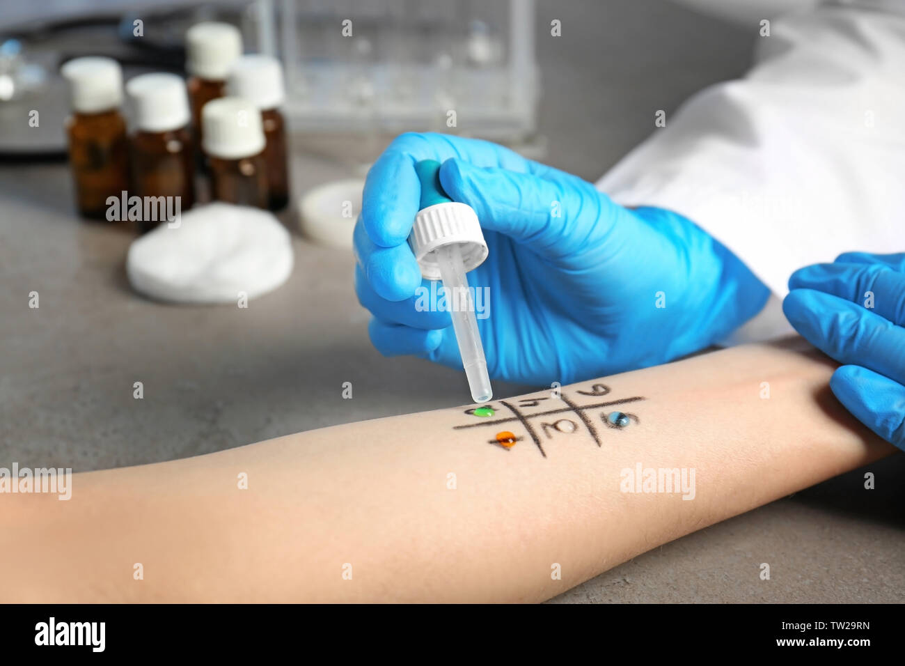 Doctor making allergy test in laboratory Stock Photo - Alamy