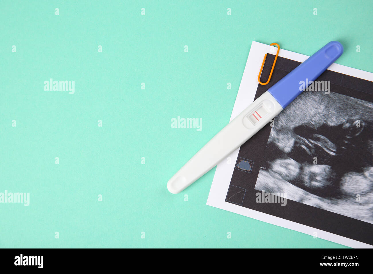 Ultrasound photo and pregnancy test on turquoise background Stock Photo ...