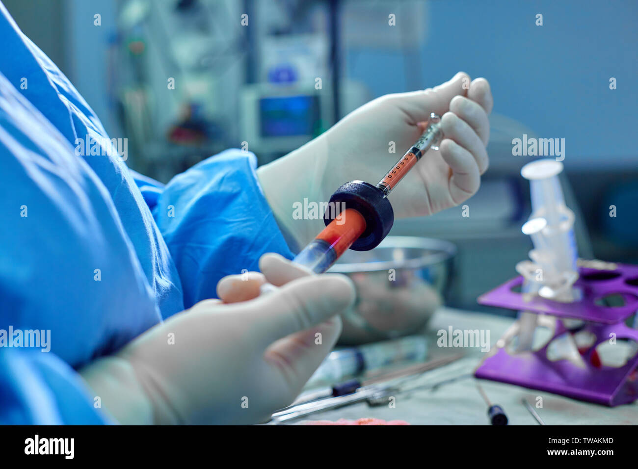 Hands Holding Syringe and Transfer Fat with Nano Fat Transfer Tool in ...