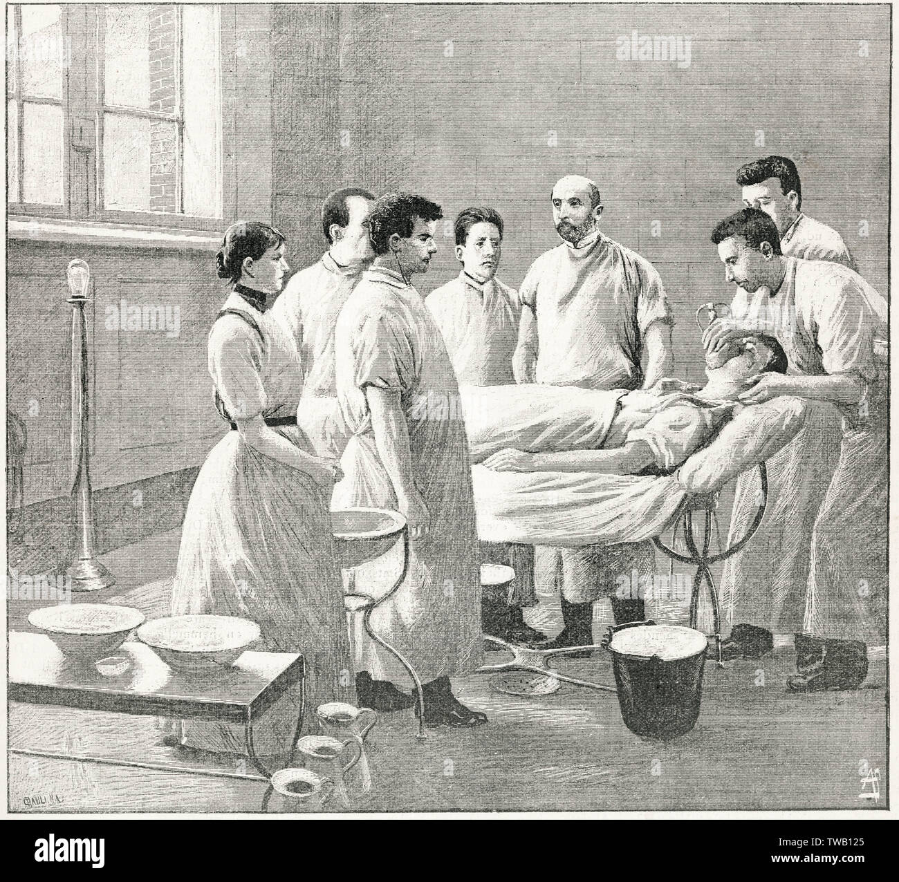 Anaesthesis of a patient before a medical operation 1888 Stock Photo ...