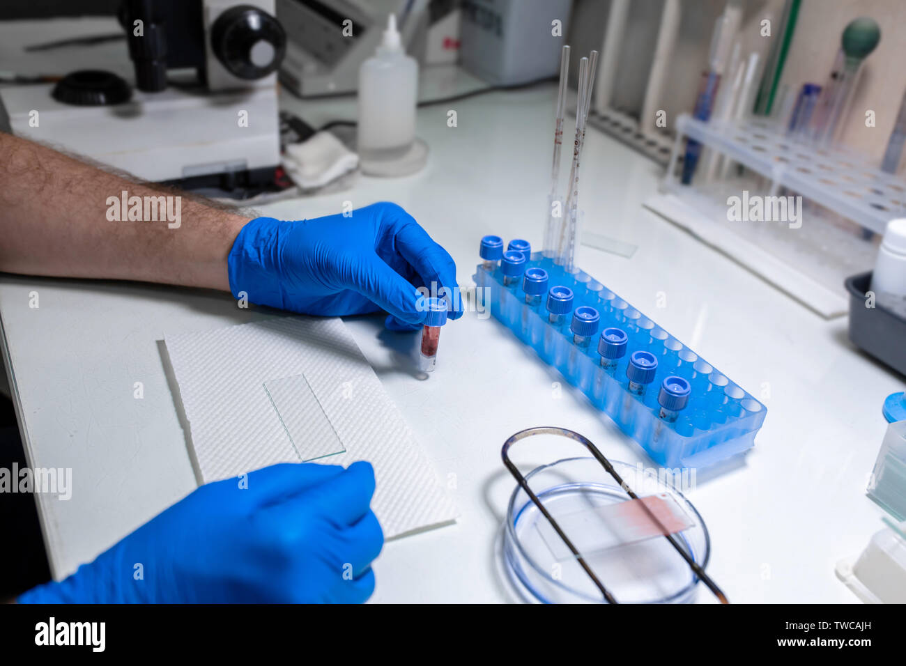 scientist prepare blood sample for research on microscope. Placing ...