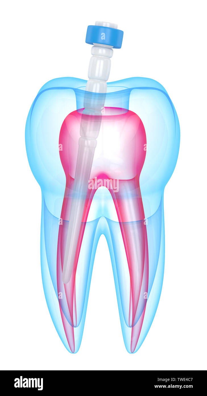 Periodontal fiber hi-res stock photography and images - Alamy