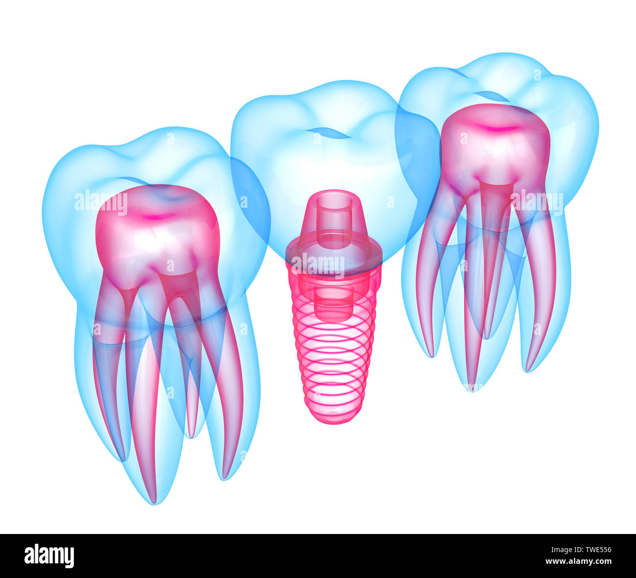 Periodontal fiber hi-res stock photography and images - Alamy