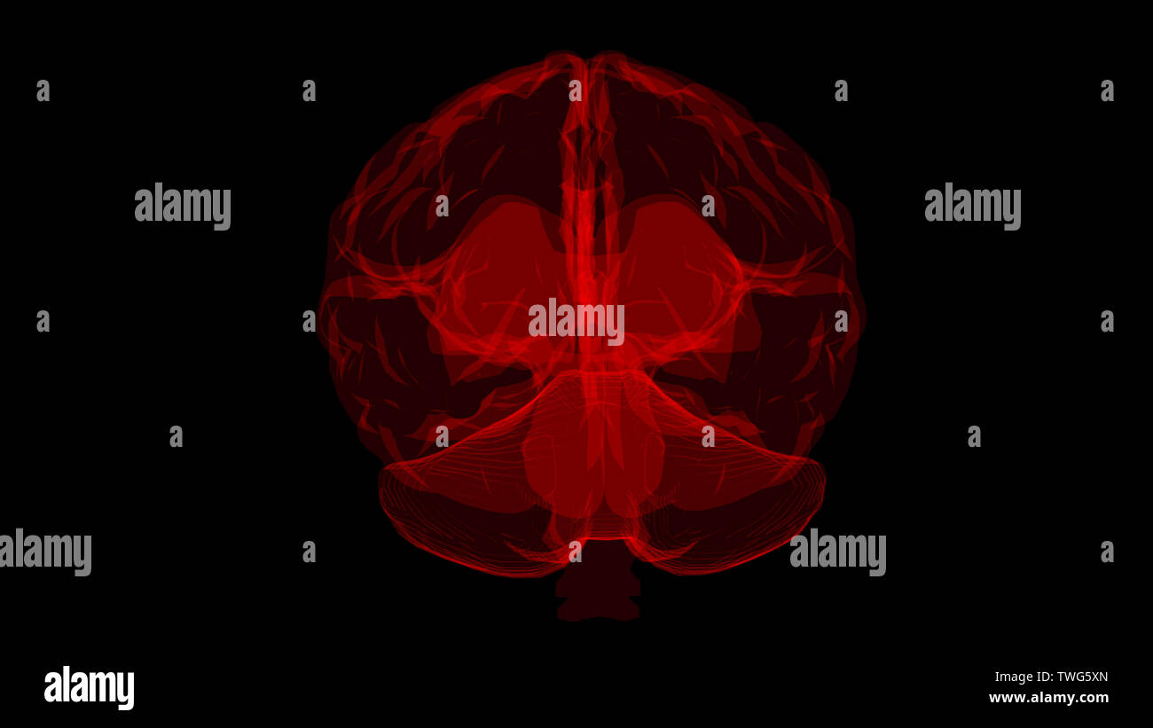 3D rendering of computer model of human brain and artificial ...