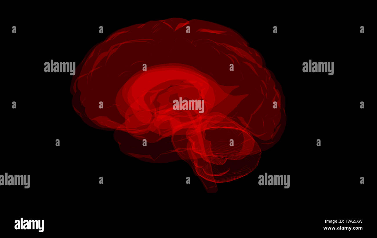 3D rendering of computer model of human brain and artificial ...