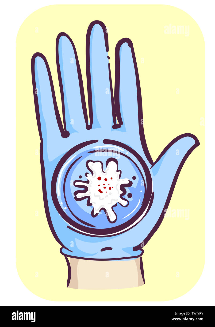 Illustration of a Gloved Hand Holding a Semen with Blood Specimen on ...