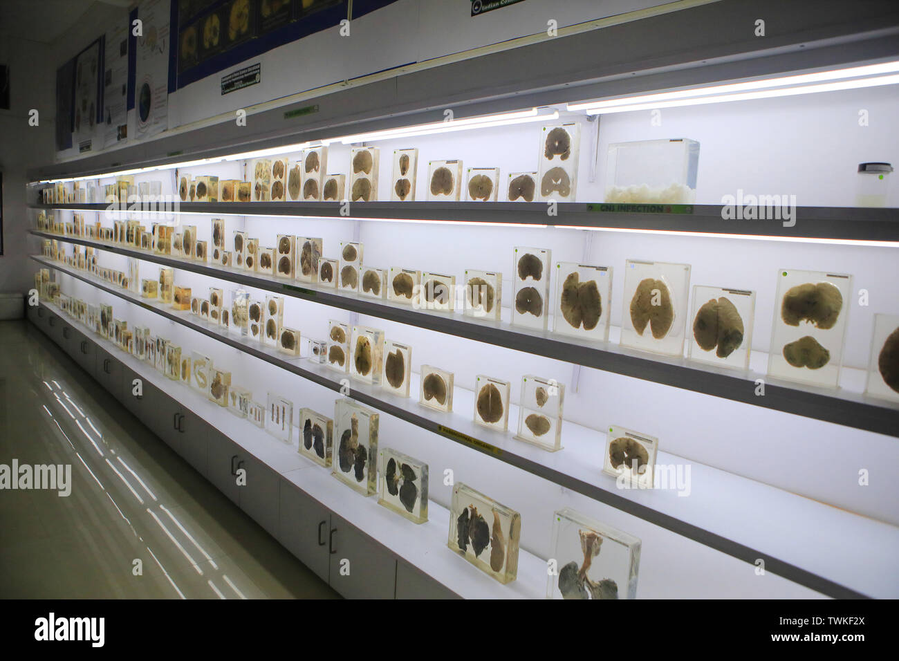 Nimhans brain museum hi-res stock photography and images - Alamy