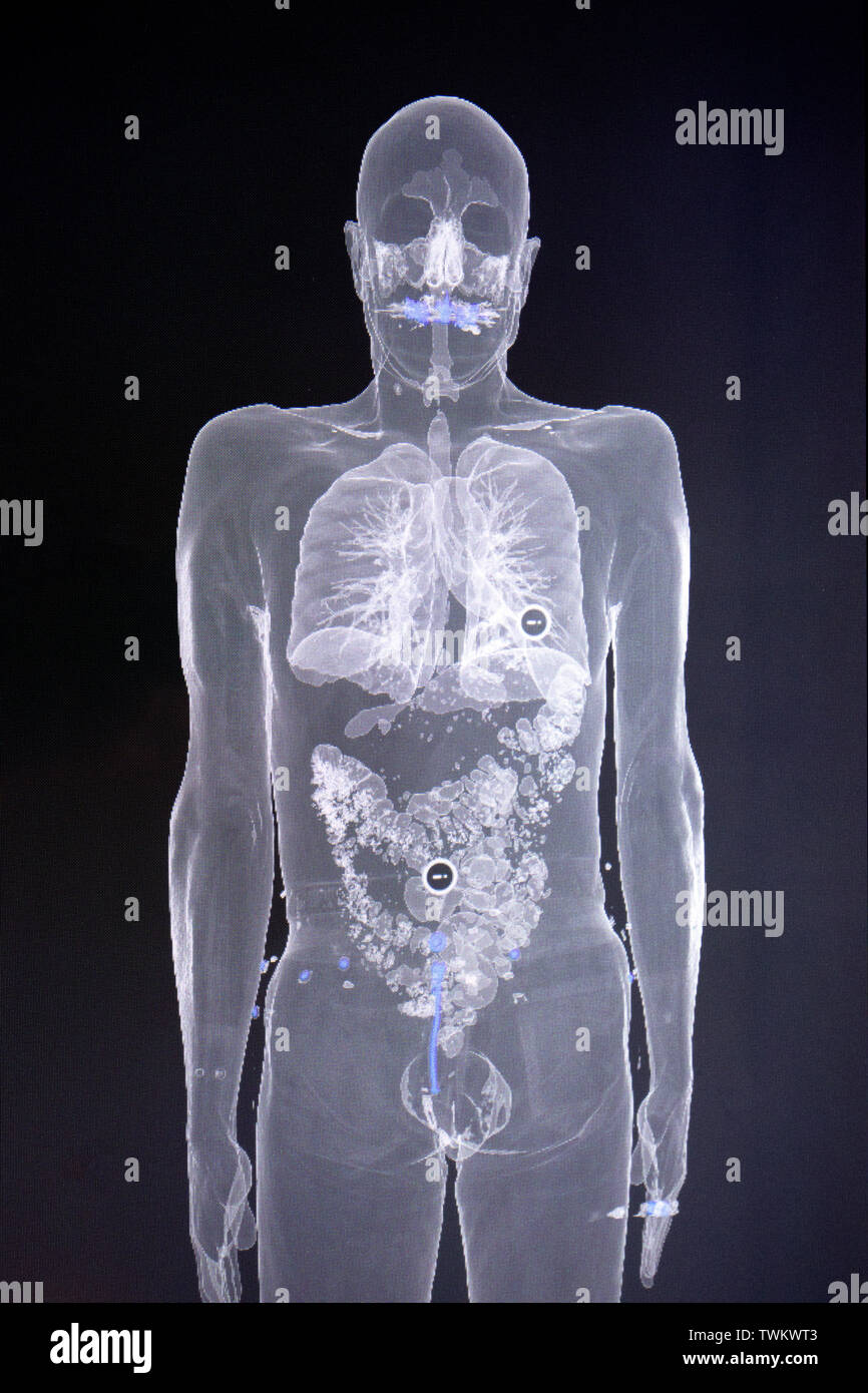 Human anatomy of the lungs hi-res stock photography and images - Alamy