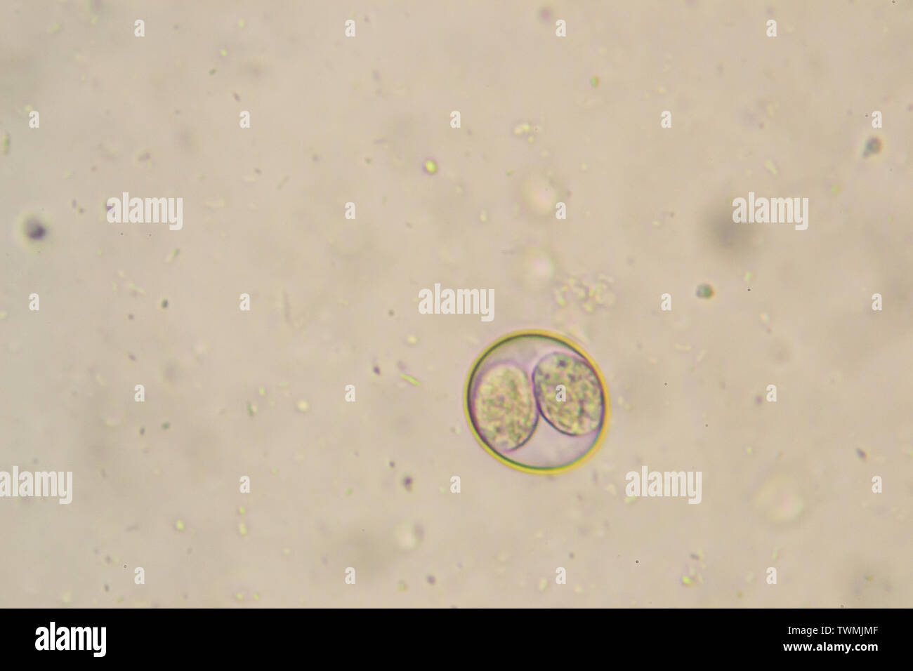 Sporulated oocyst of Eimeria/Isospora isolated from infected samples of ...