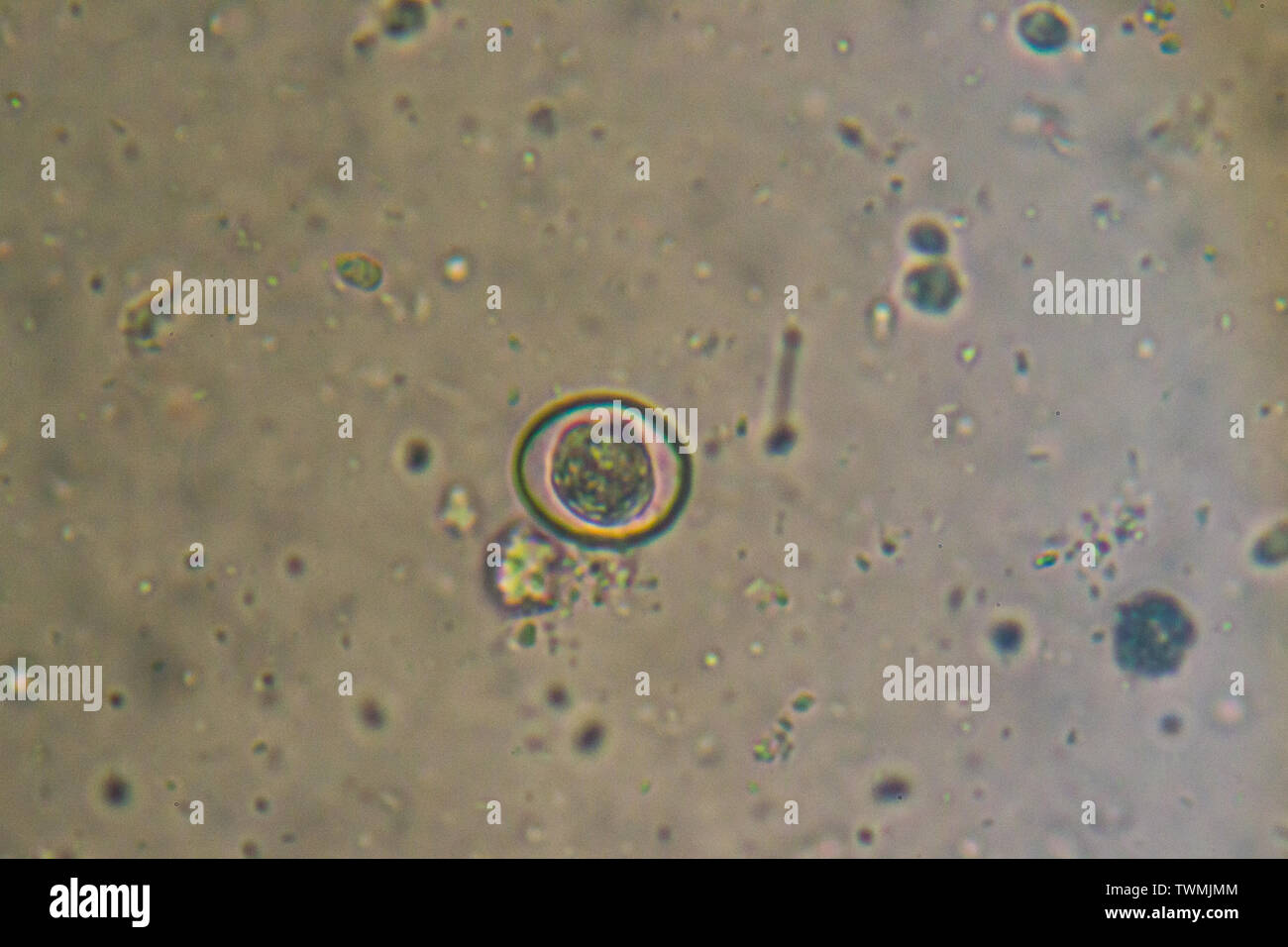 unsporulated oocyst of Eimeria/Isospora isolated from infected samples ...