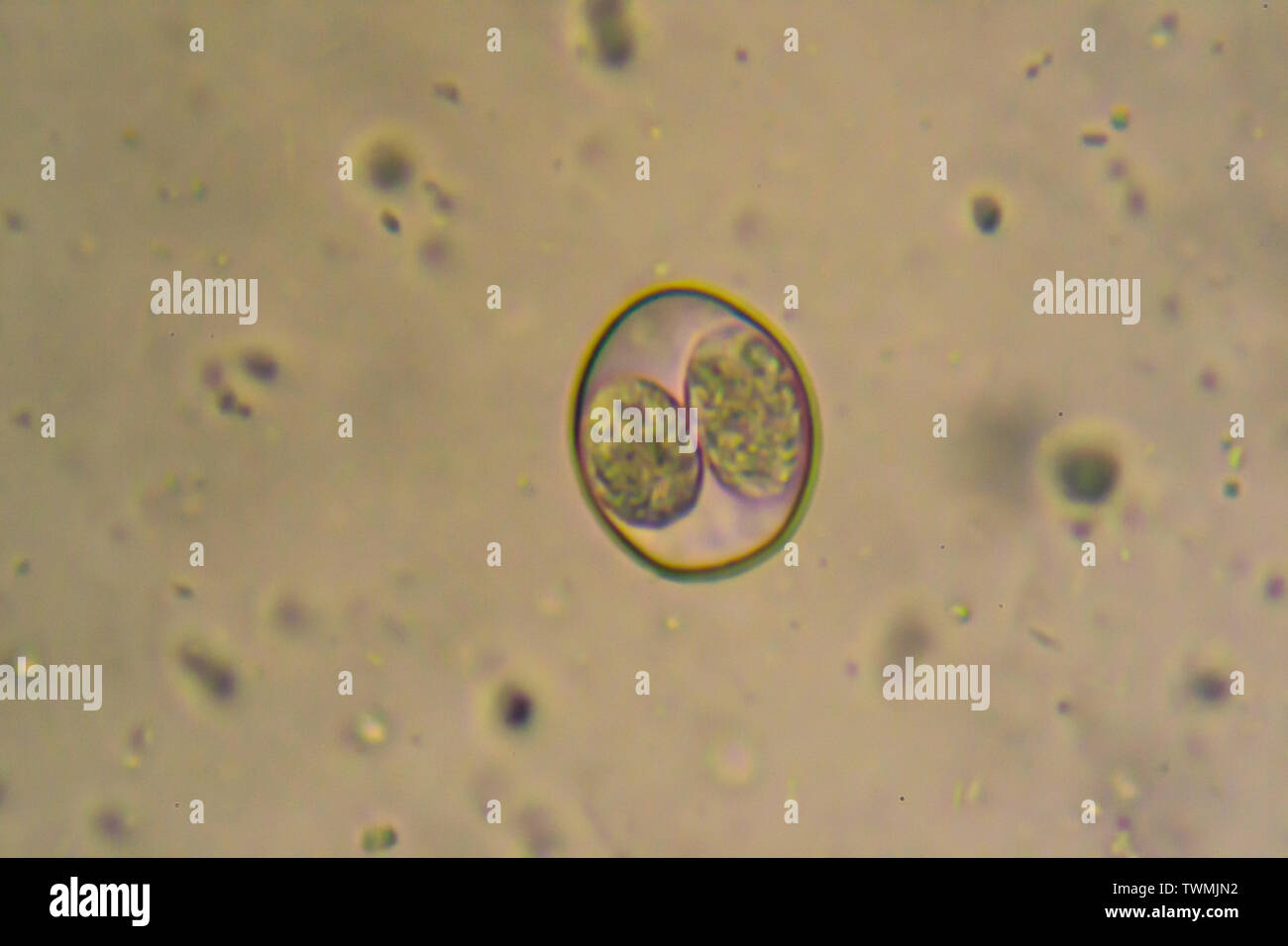 Sporulated oocyst of Eimeria/Isospora isolated from infected samples of ...
