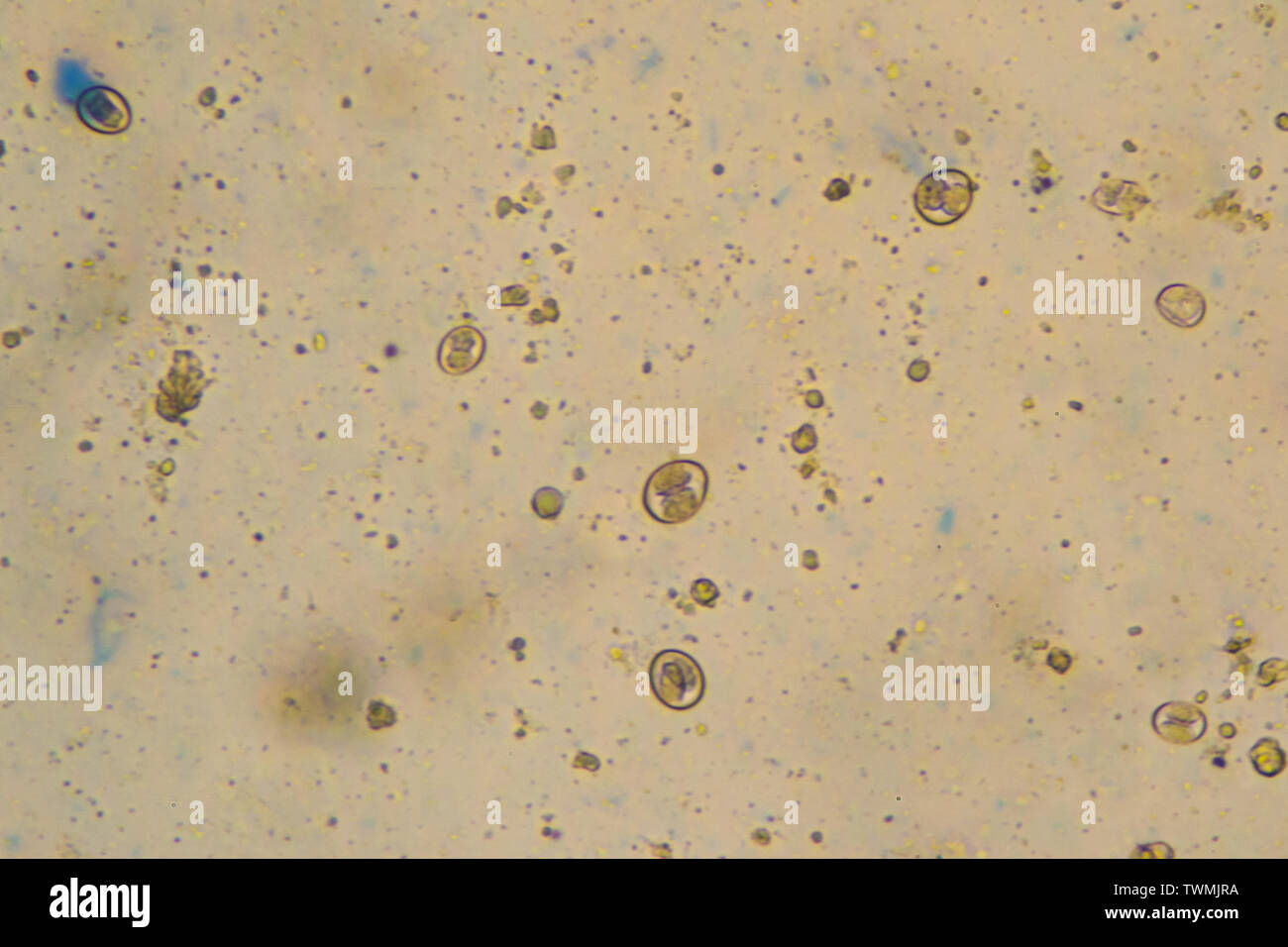 Isospora Dog And Cat Protozoa