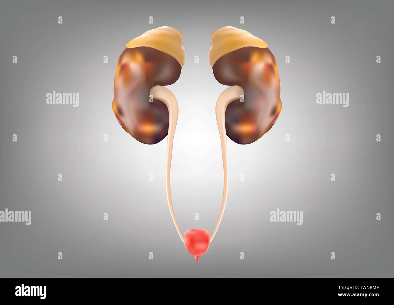 Human Kidney presents a medical concept as a organ that has the ...