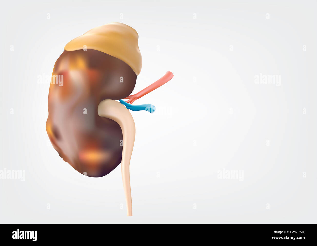 Human Kidney presents a medical concept as a organ that has the ...
