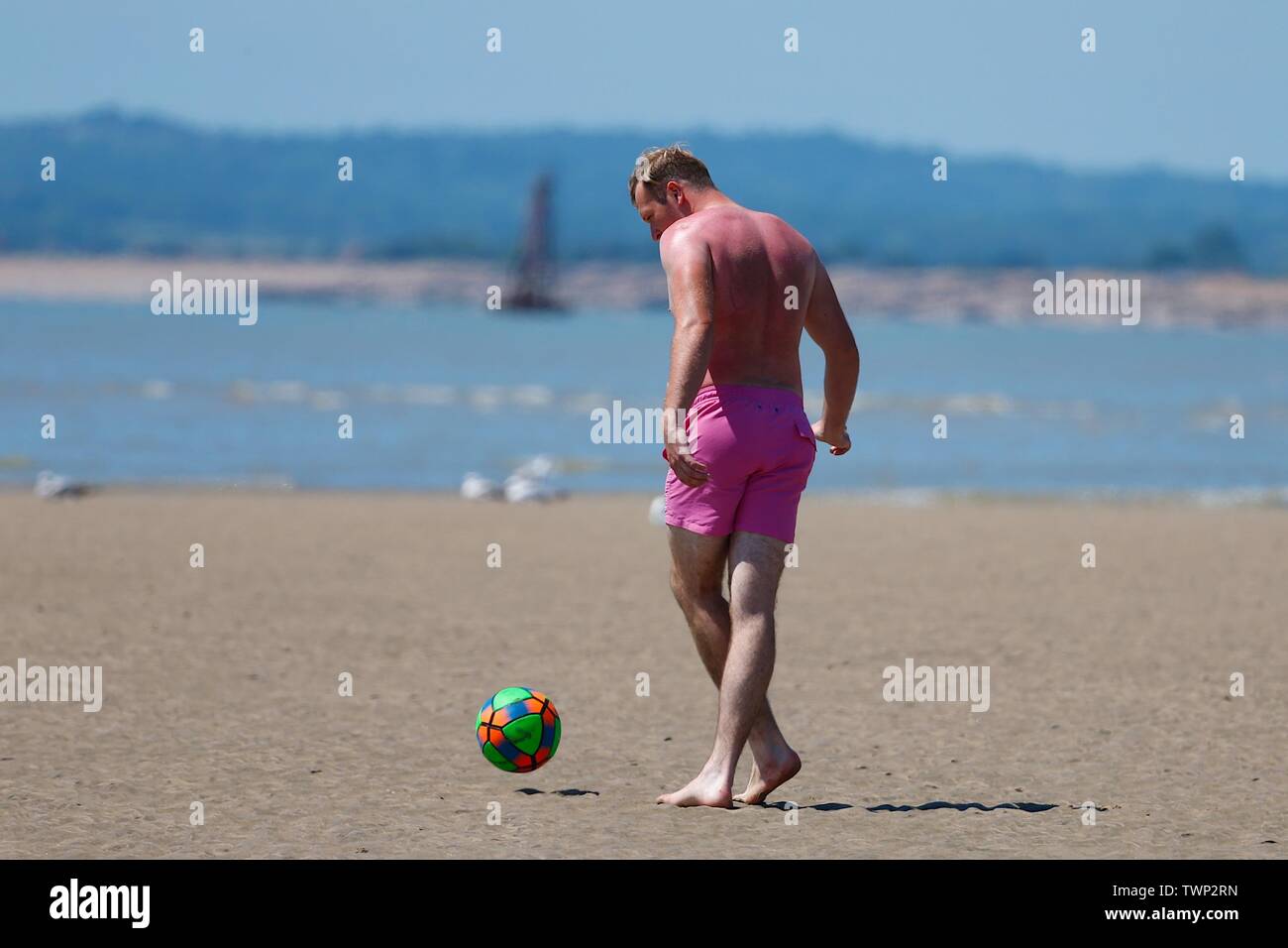 Sunburnt man beach hi-res stock photography and images - Alamy