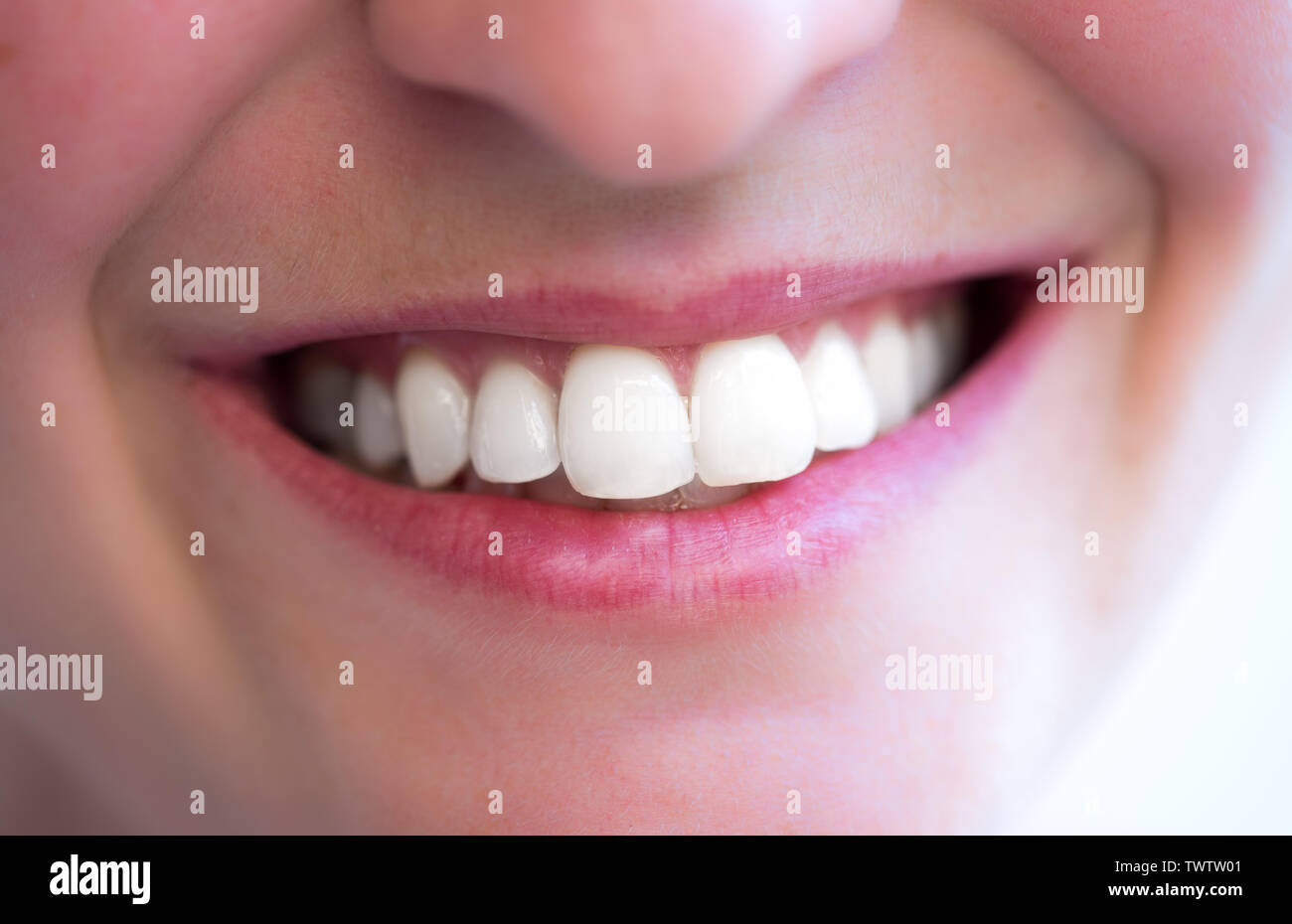 Healthy white teeth of a young woman, close up picture Stock Photo - Alamy