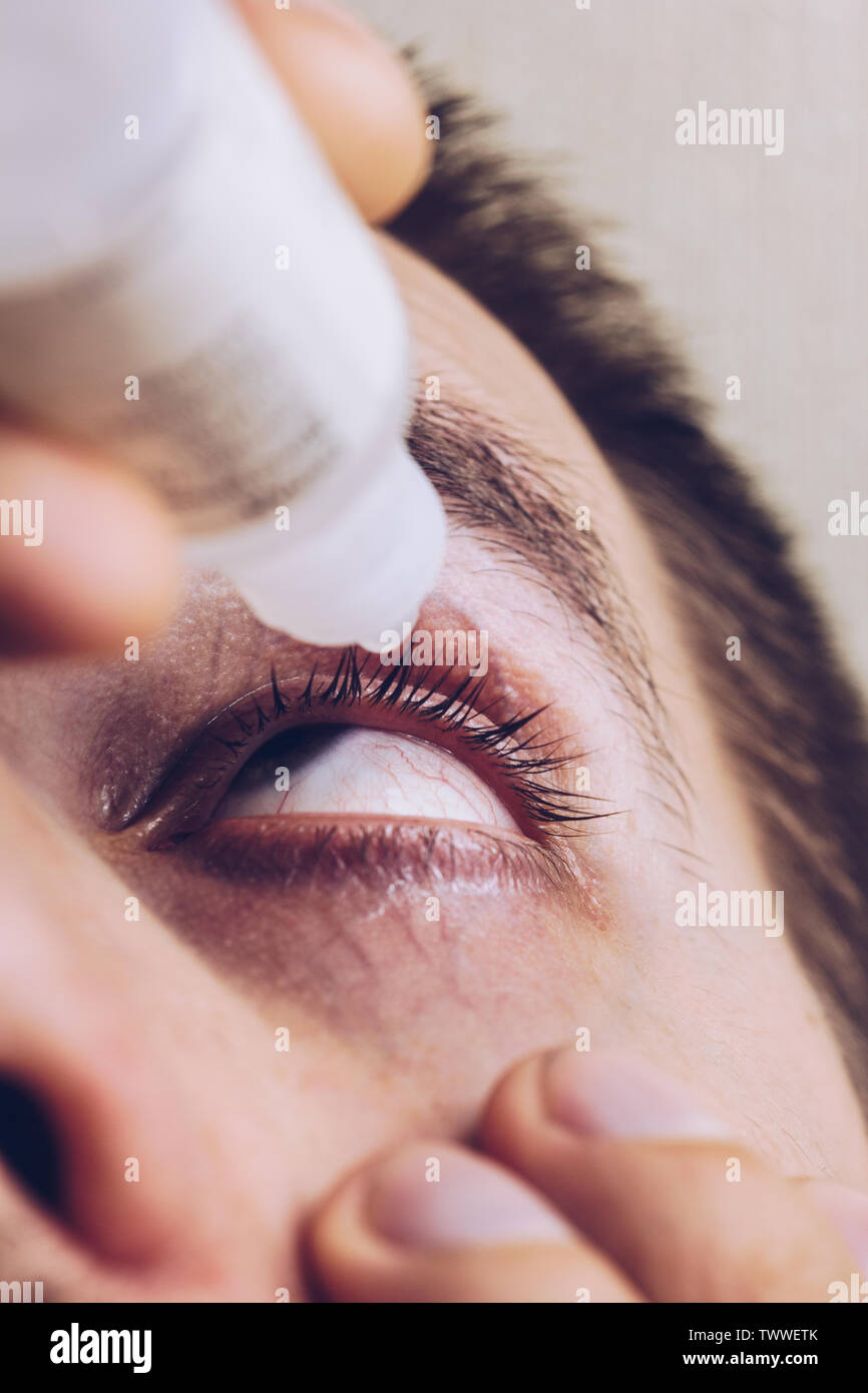 a man drips open human eye with bright red arteries drops to improve ...