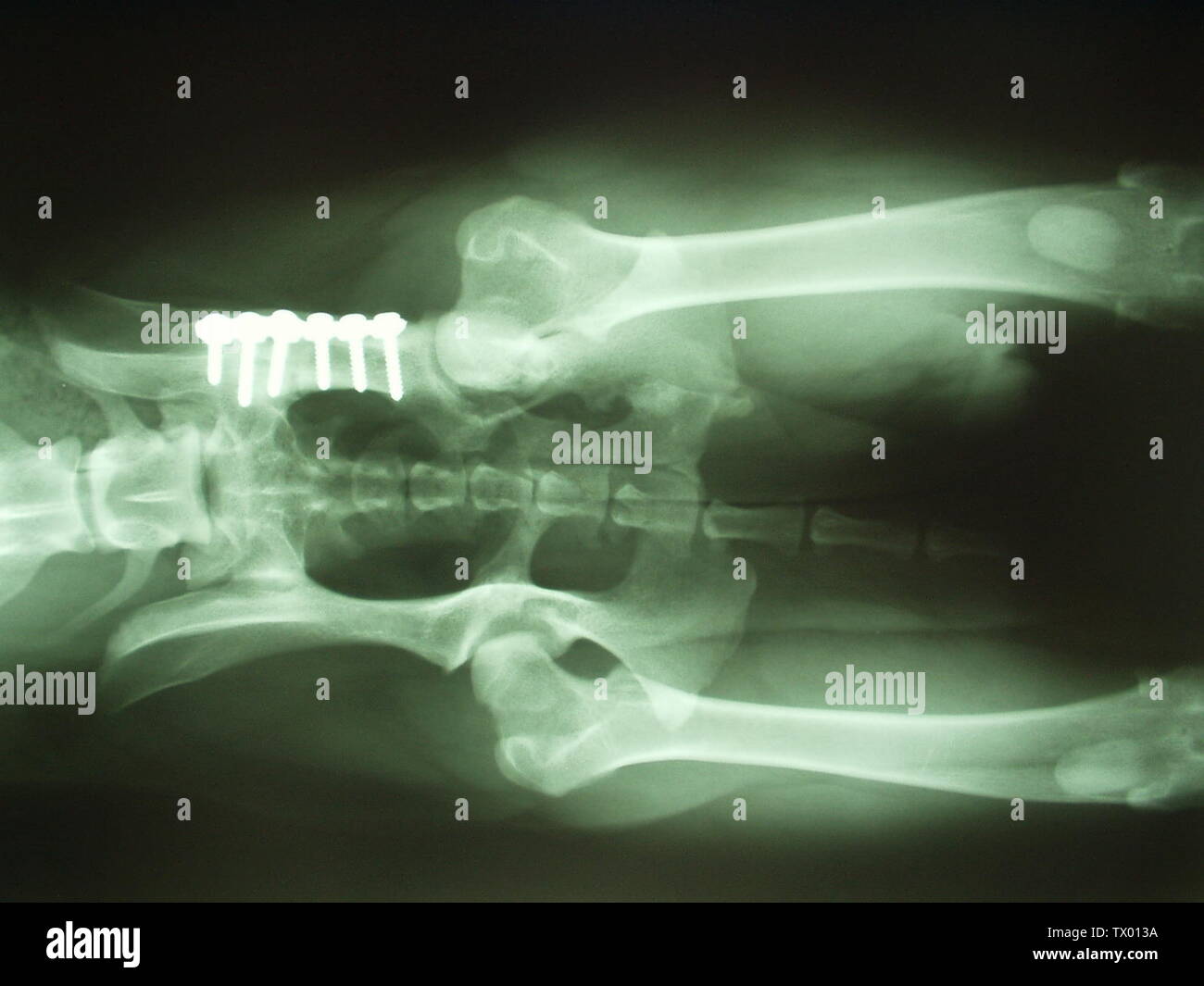 Rontgenfoto hi-res stock photography and images - Alamy