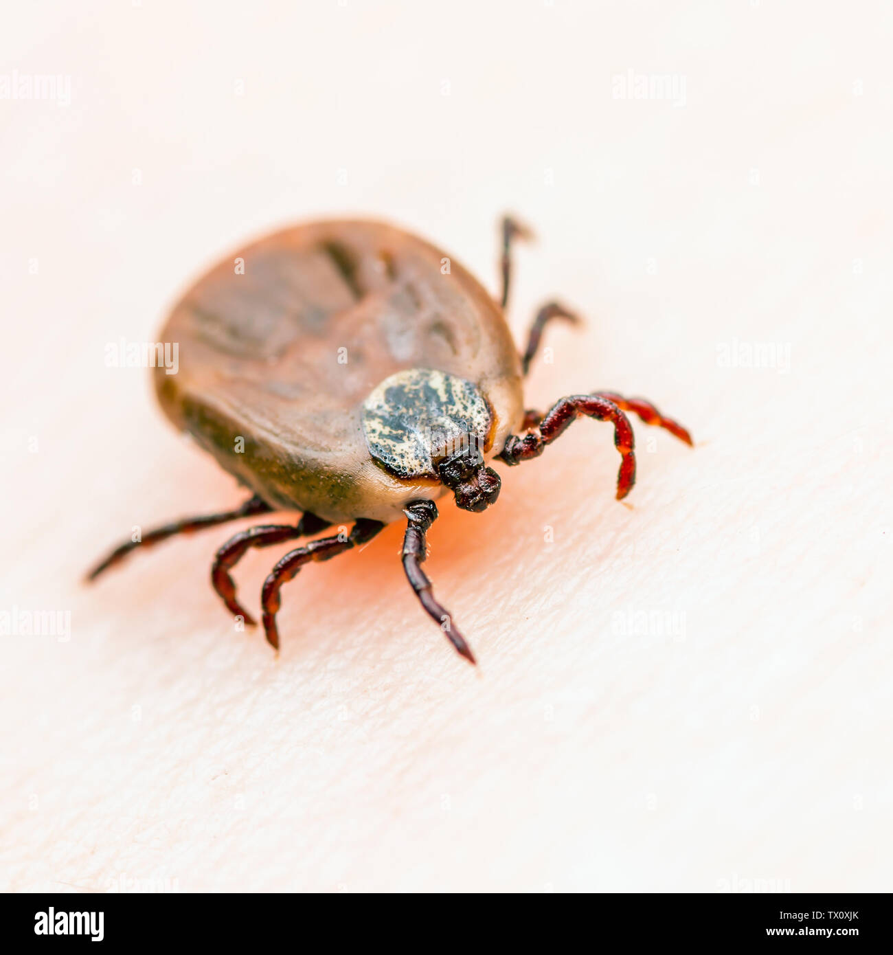 Bacterial skin disease hi-res stock photography and images - Alamy