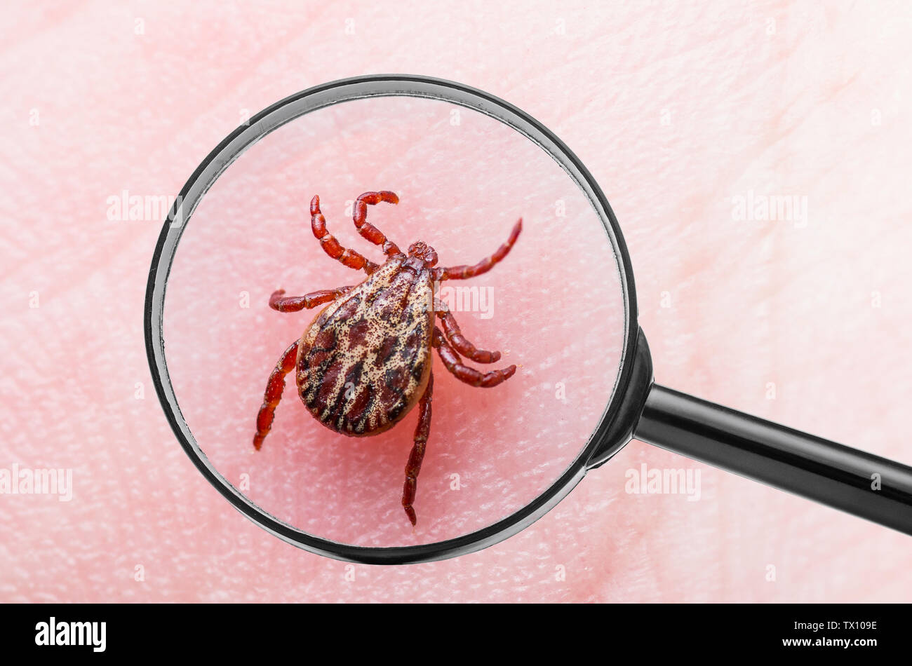 Parasitic mite infection of the skin hi-res stock photography and ...
