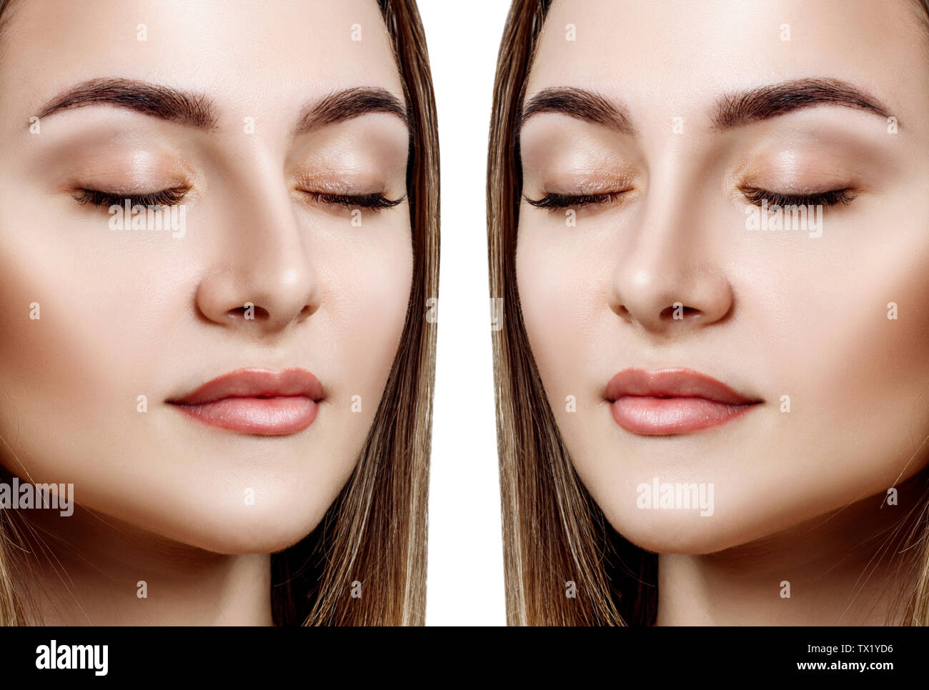 Female nose before and after cosmetic surgery Stock Photo - Alamy
